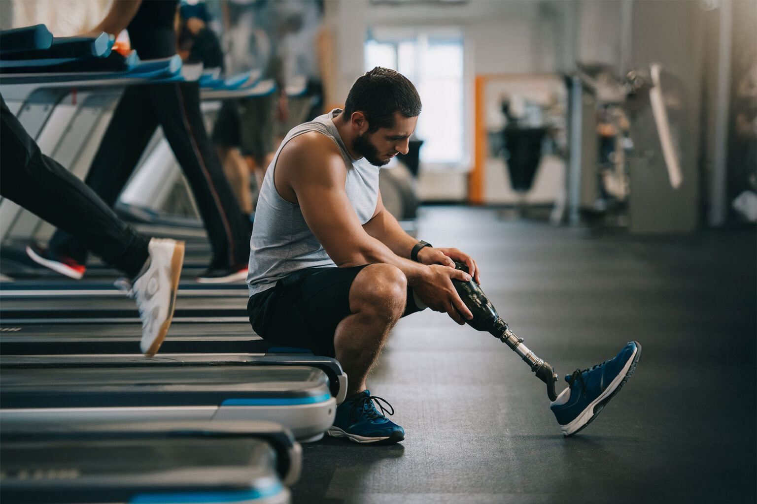 Cardiovascular Impact of Limb Loss: Why Arterial Health Matters