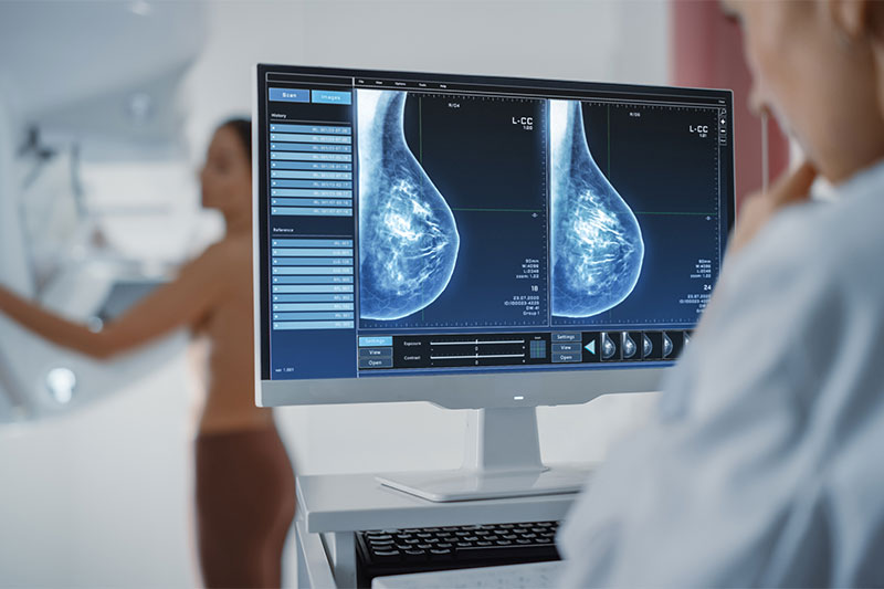 CONNEQT Health Insights - Arterial Intelligence